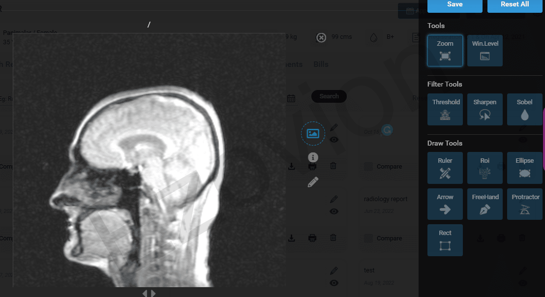 Radiology and PACS Software | Ezovion Healthcare