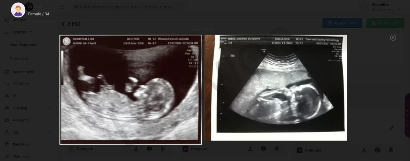 Radiology and PACS Software | Ezovion Healthcare